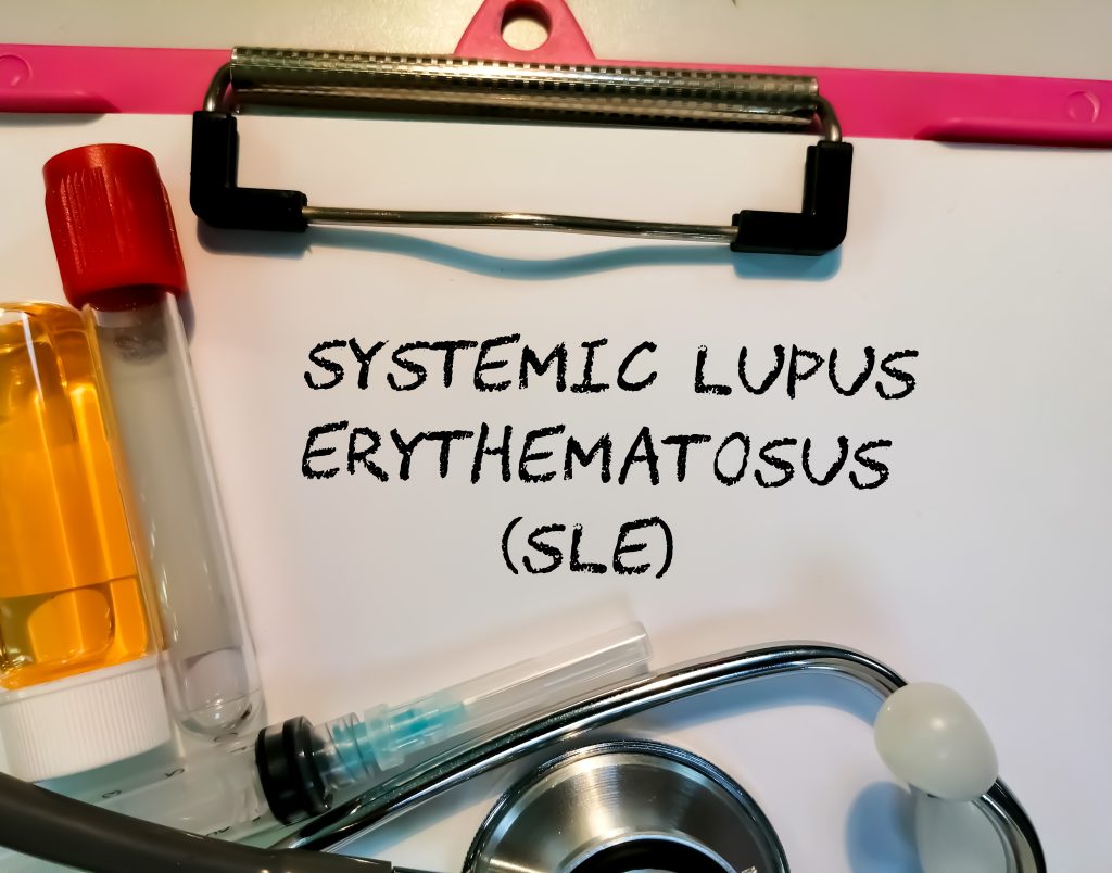 Aplikasi Sel Punca: Systemic Lupus Erythematosus (SLE) pada Anak – Tim ...
